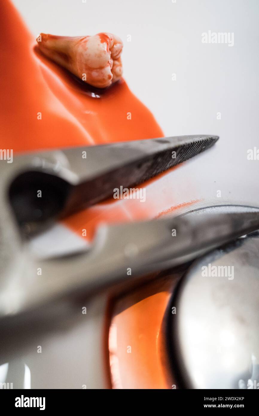 Seattle, USA. 22 Jan, 2024. Self tooth extraction concept Stock Photo ...