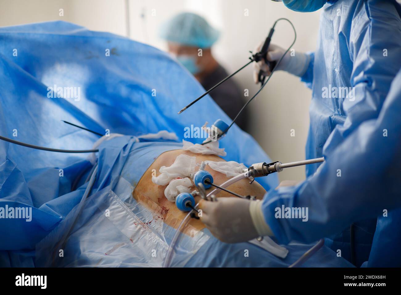 doctors perform laparoscopy operations in the intensive care unit Stock ...