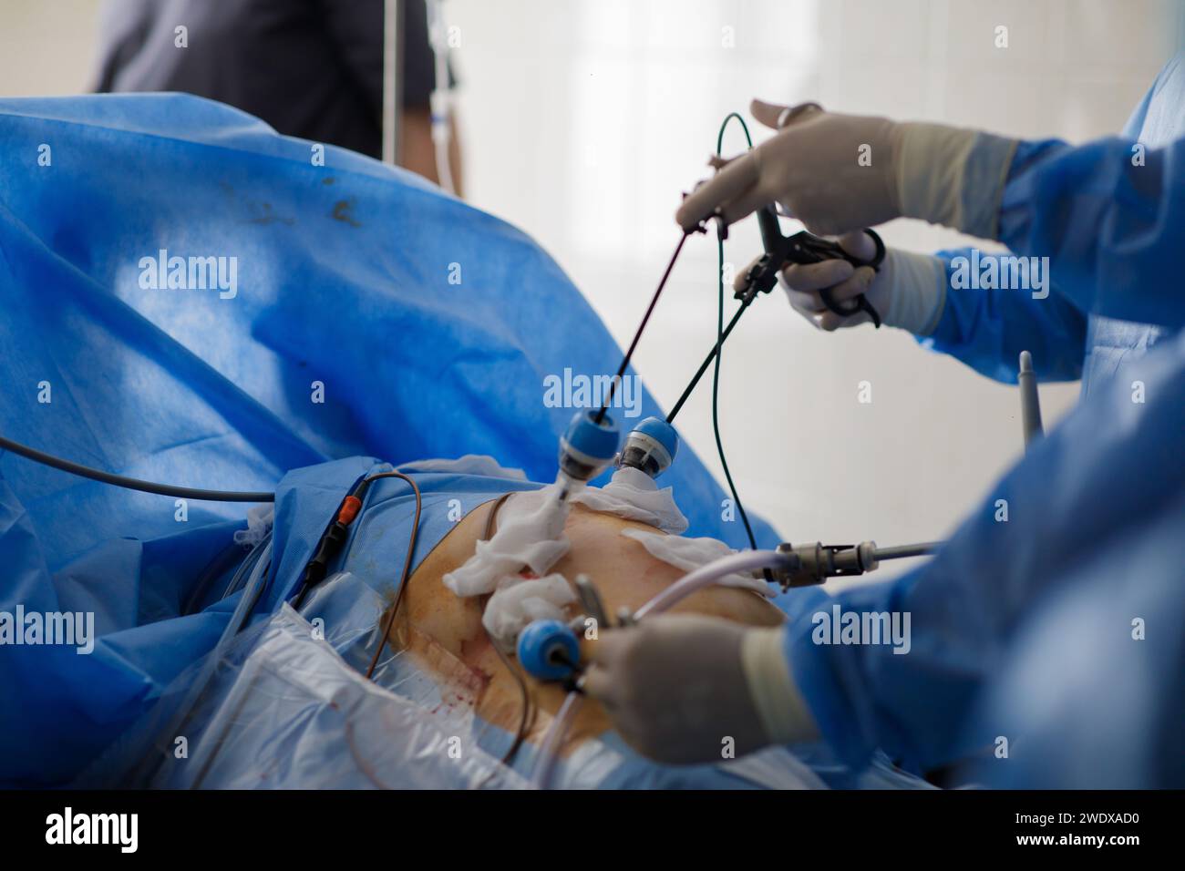Endoscopy machines hi-res stock photography and images - Alamy