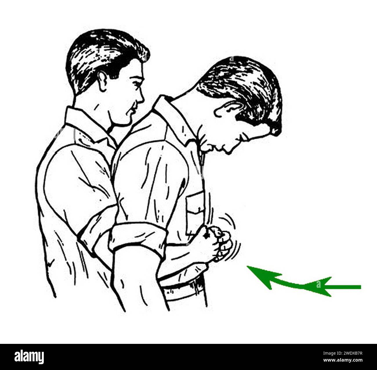 Abdominal thrusts against choking (cropped Stock Photo - Alamy