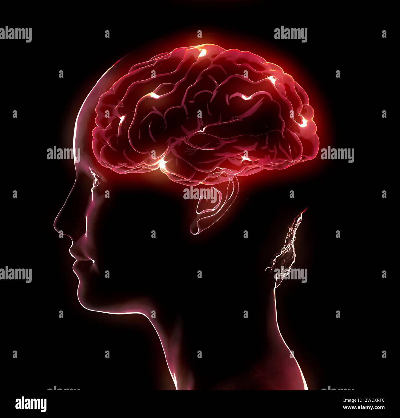 Memory lapses, forgetting things, degenerative disease. Brain problems ...