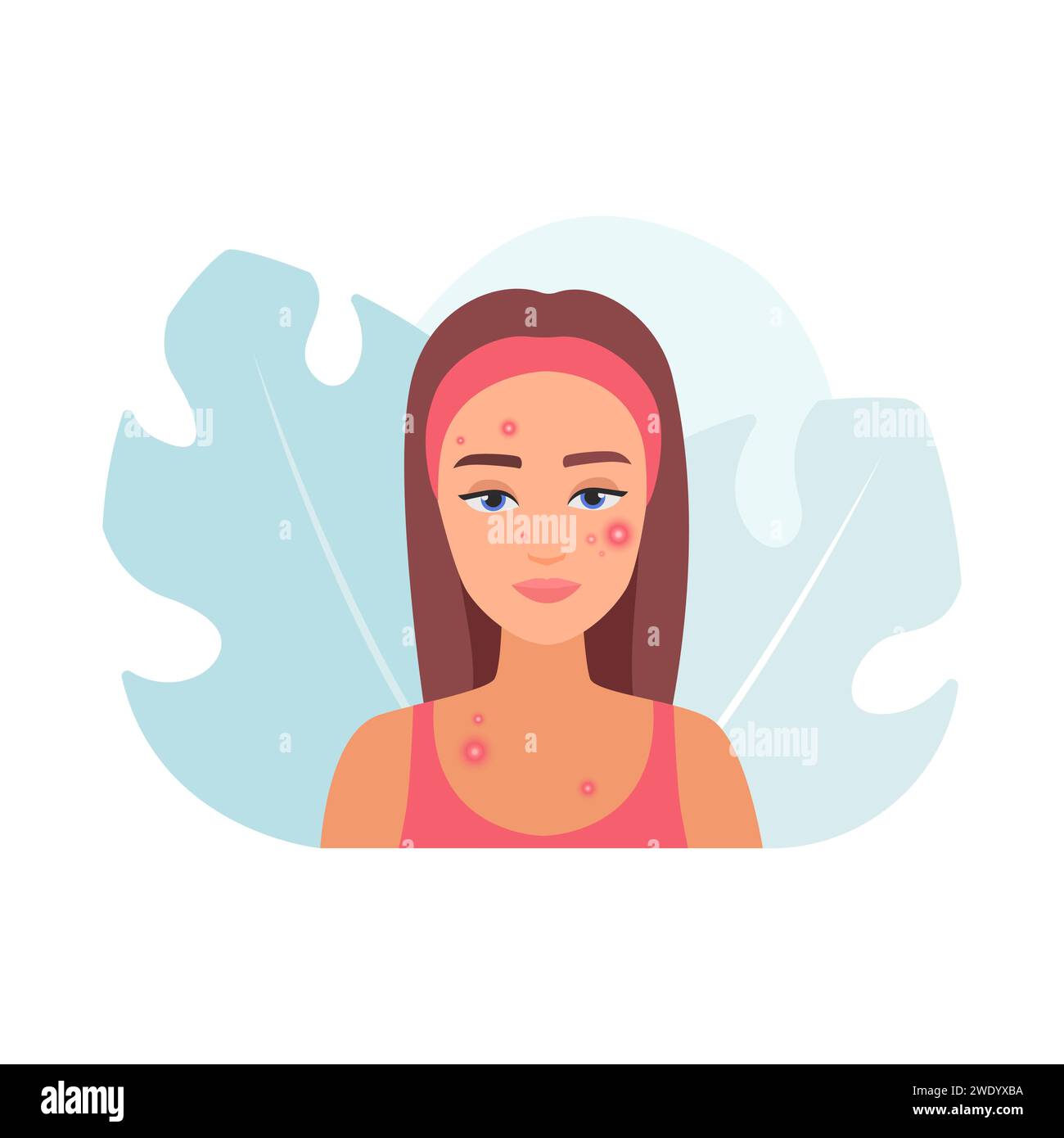 Young woman with acne puberty problem and red pimples on face vector ...