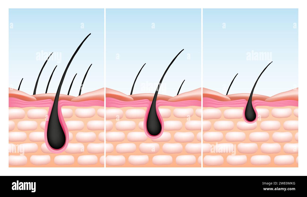 Scalp Skin Hair Root Reduce Bulb Or Follicle Fall Baldness And