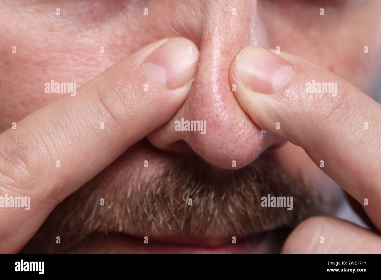Man popping pimple on his nose, closeup Stock Photo - Alamy