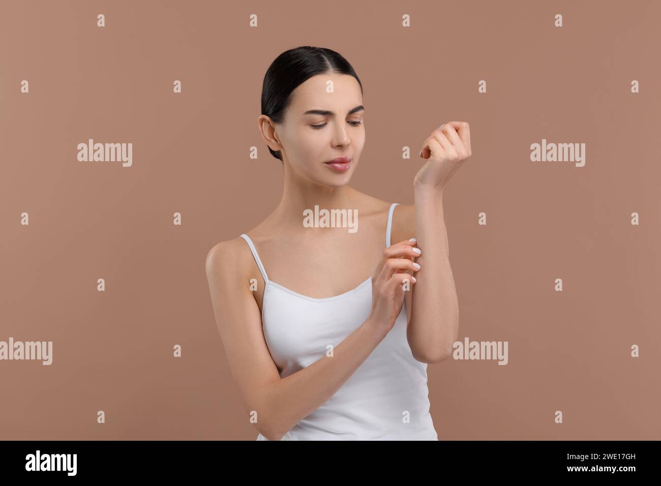 Woman with rash on her arm hi-res stock photography and images - Alamy