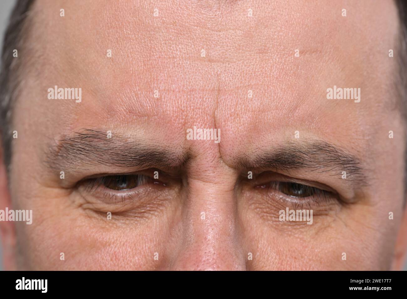 Wrinkles on the forehead hi-res stock photography and images - Alamy