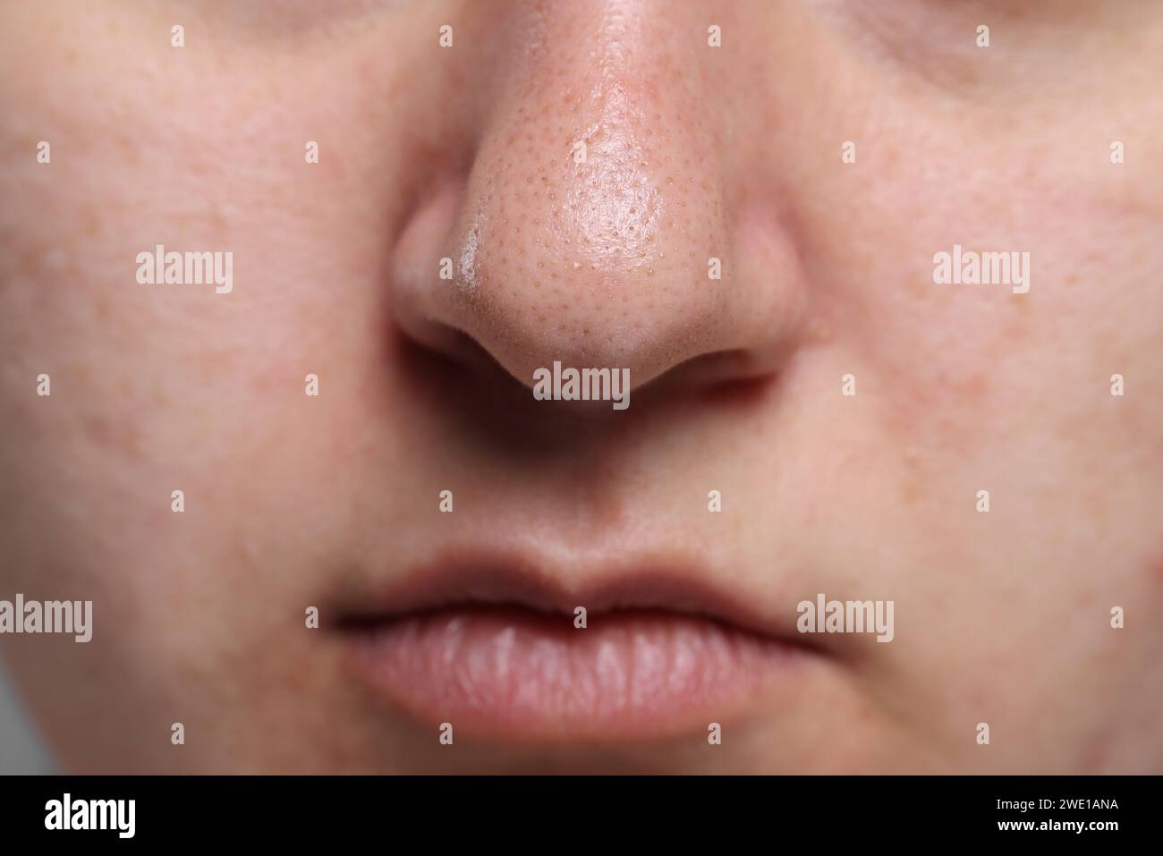 Skin texture on the nose hi-res stock photography and images - Alamy