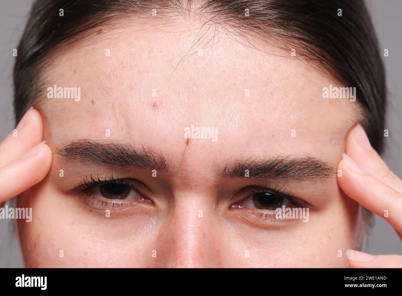 Closeup view of woman with wrinkles on her forehead against grey ...