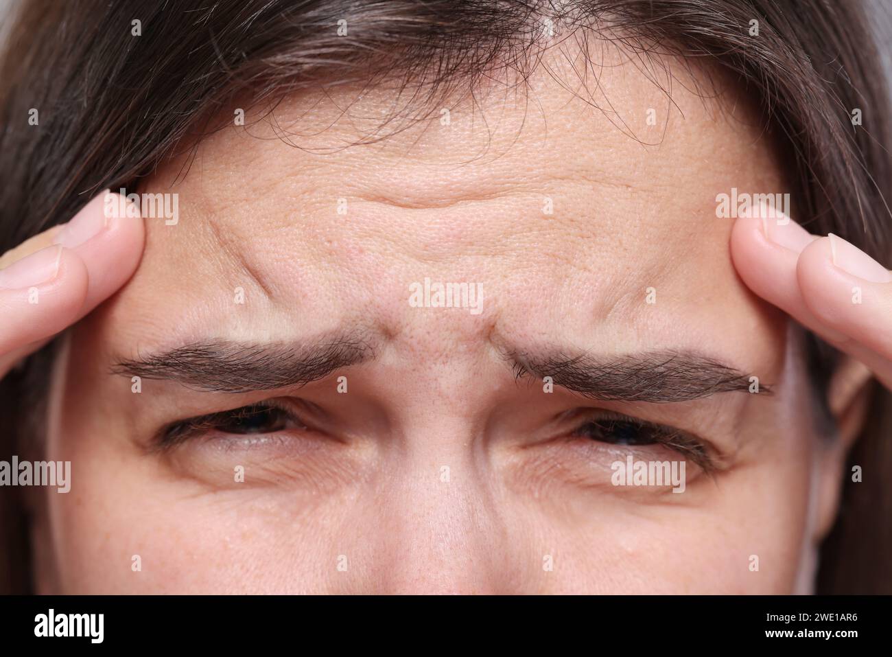 Closeup view of woman with wrinkles on her forehead Stock Photo - Alamy
