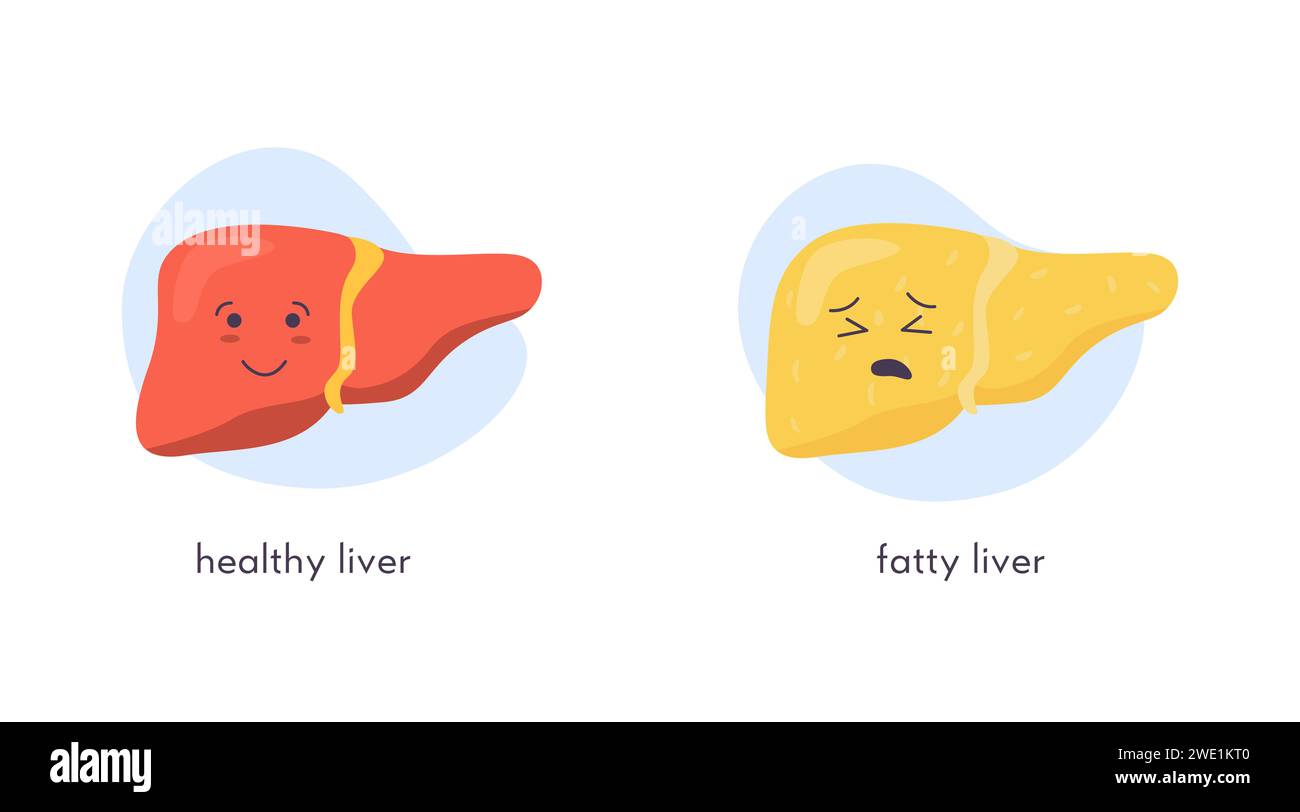 Unhealthy fatty and healthy happy liver character. Sad kawaii crying ...