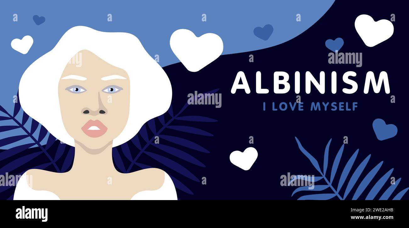 Banner about albinism with a young beautiful African American woman ...