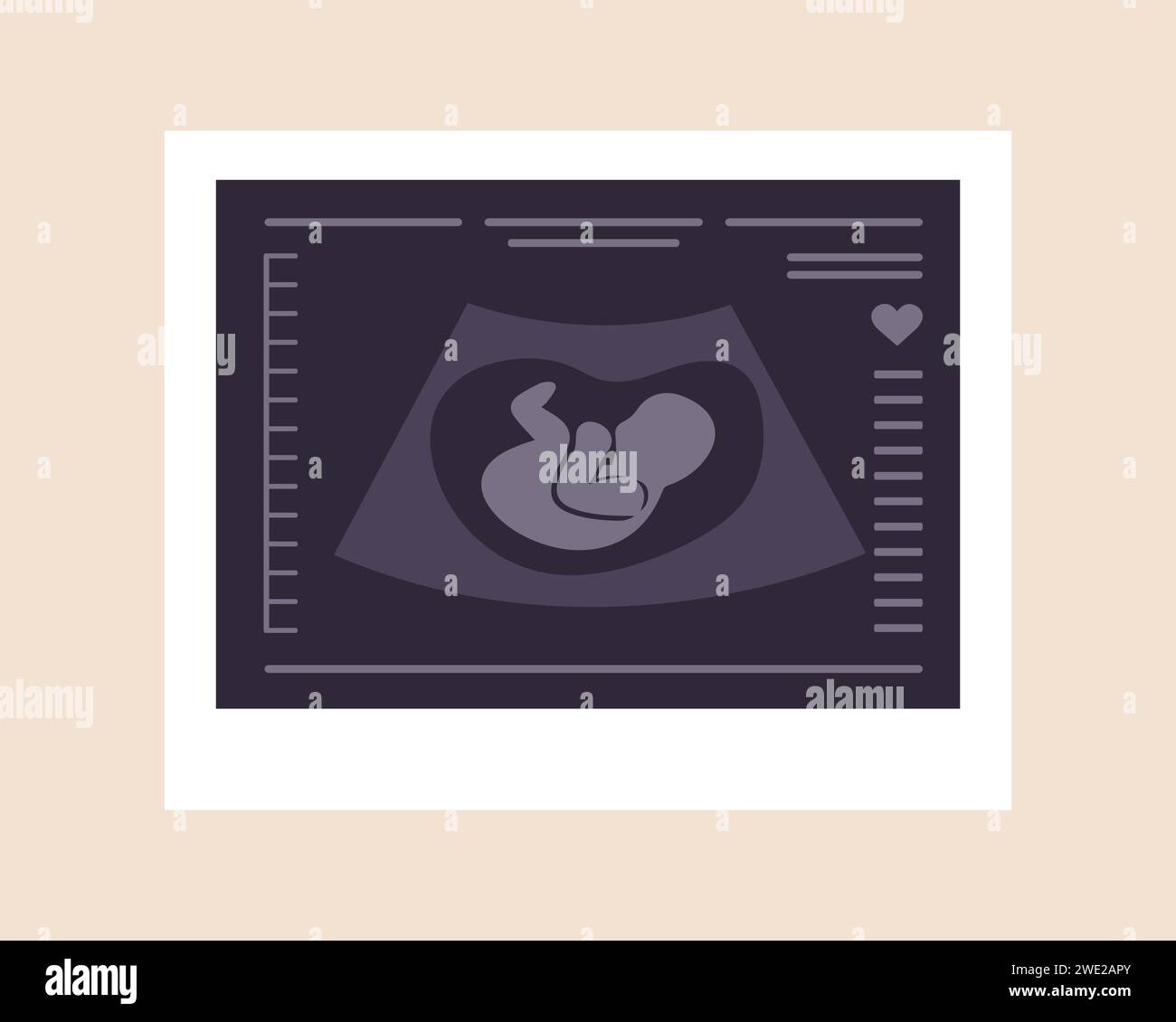 Ultrasound of baby. Embryo in womb. Pregnancy screening. Baby health ...