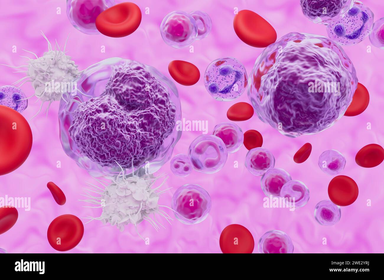 Hodgkin and non hodgkin lymphoma hi-res stock photography and images ...