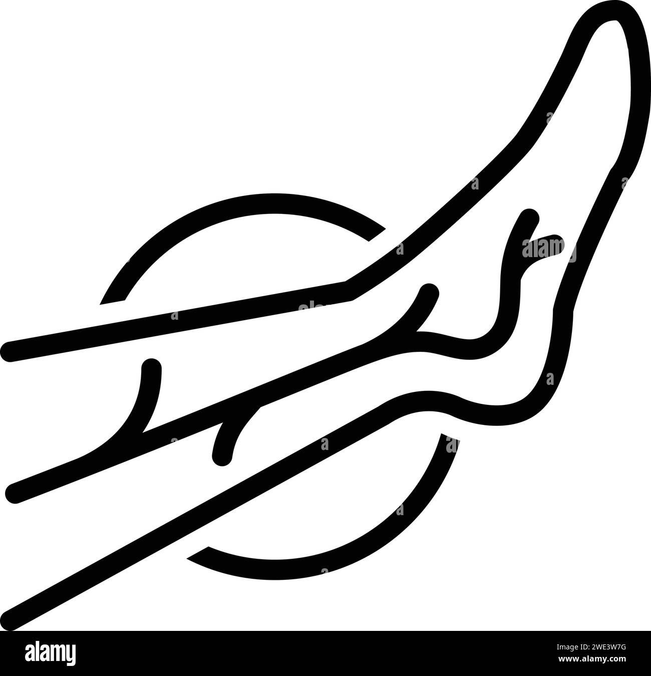 Thrombophlebitis vector vectors hi-res stock photography and images - Alamy