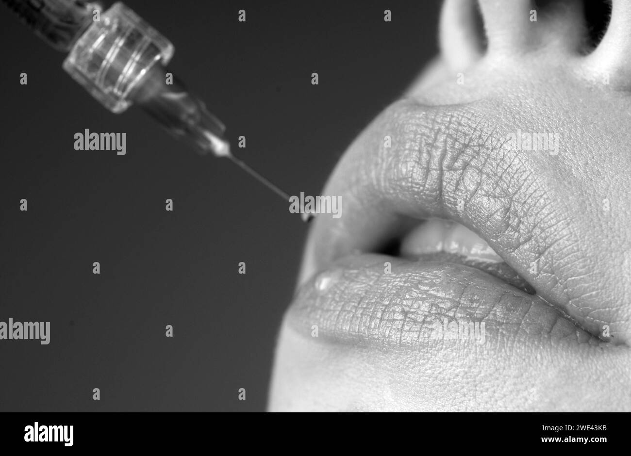 Closeup of lips augmentation. Syringe female mouth. Cosmetology ...