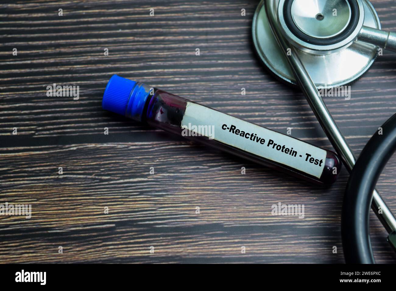 c-Reactive Protein - Test with blood sample on wooden background ...