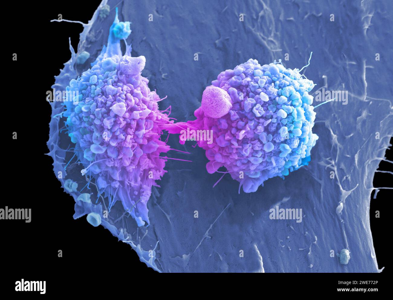 Cervical cancer cells dividing, SEM Stock Photo - Alamy