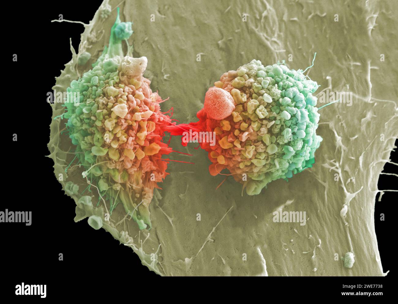 Cervical cancer cells dividing, SEM Stock Photo - Alamy