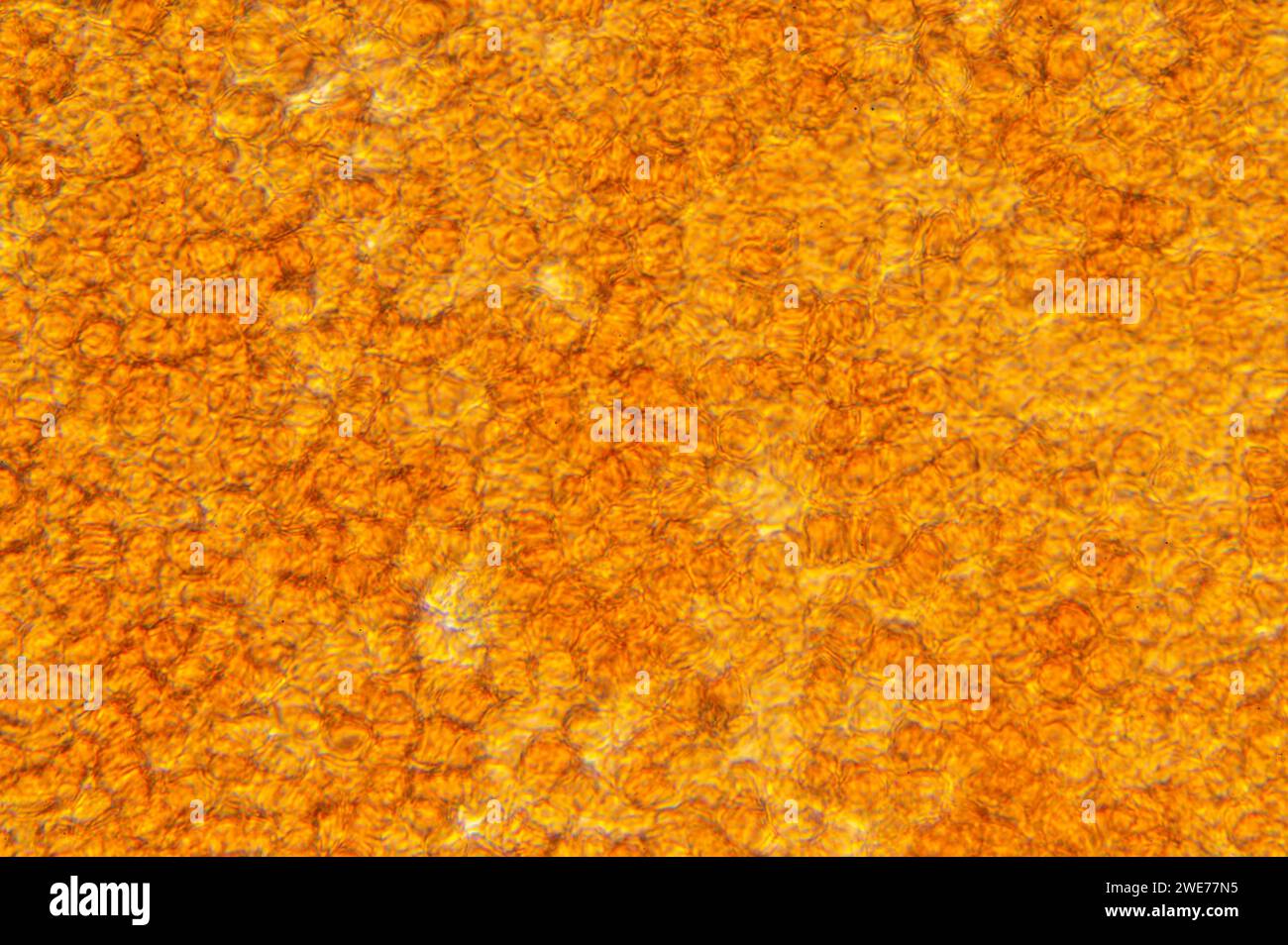 Human red blood cells, light micrograph Stock Photo - Alamy