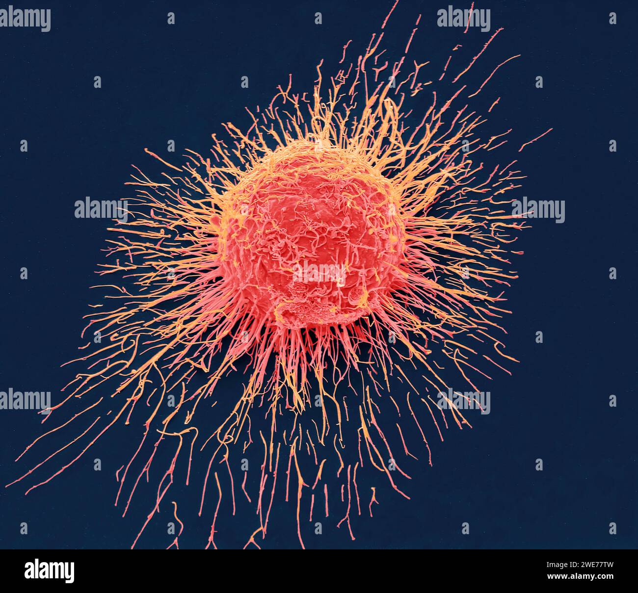 Hela cell, SEM Stock Photo - Alamy