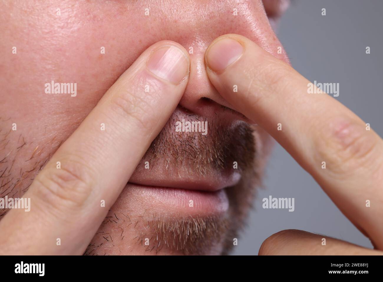 Man popping pimple on his nose against grey background, closeup Stock ...