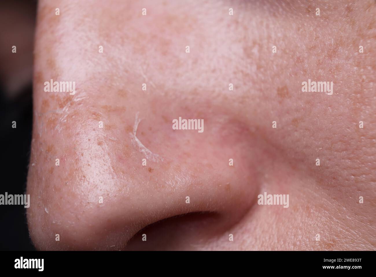 Pores on human skin macro hi-res stock photography and images - Alamy