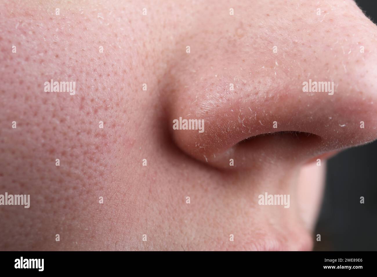 Itchy nose hi-res stock photography and images - Alamy