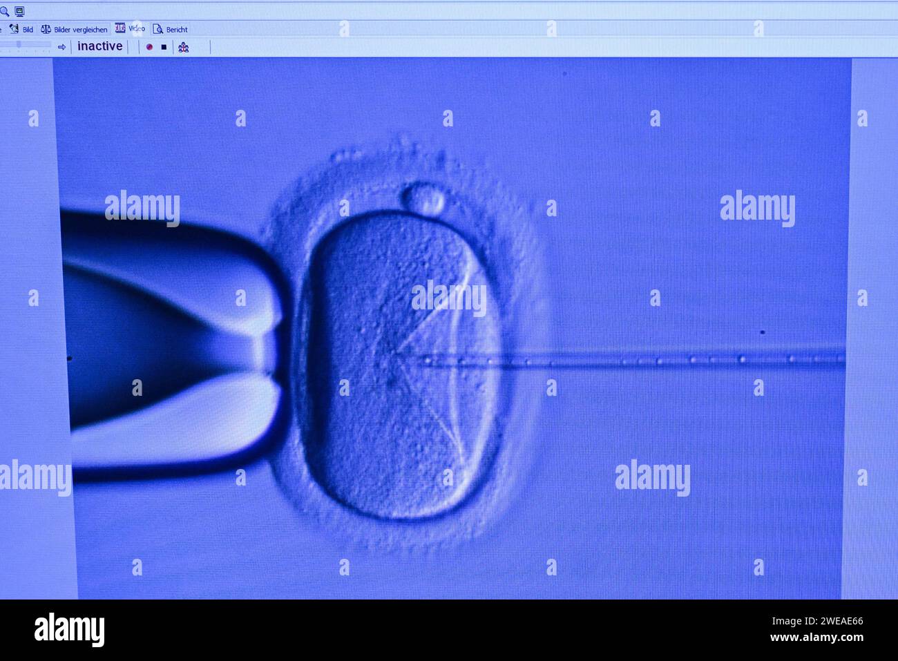 PRODUCTION - 17 January 2024, Berlin: In the cell laboratory at the ...