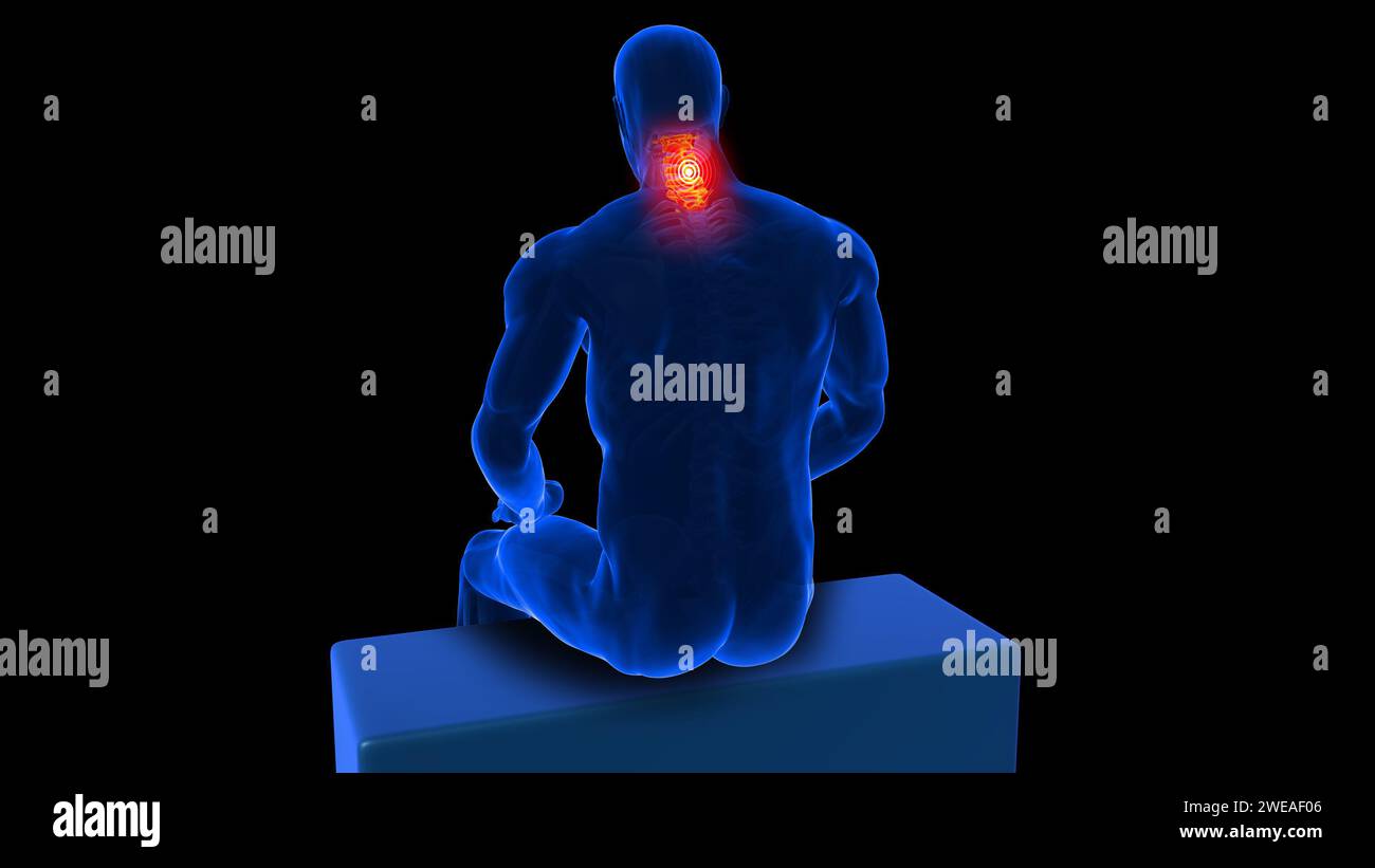 Human skeleton neck pain anatomy for medical concept 3D illustration ...