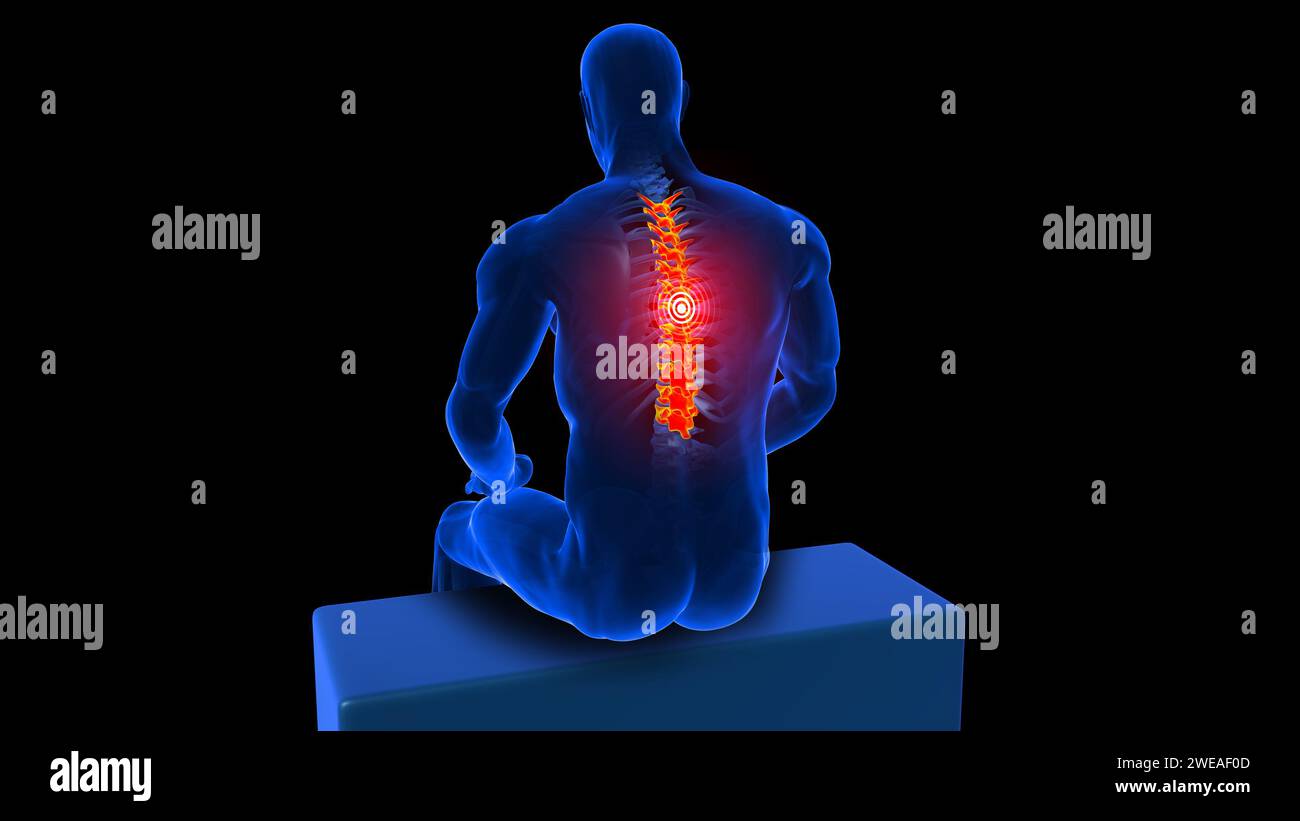 Human skeleton back pain anatomy for medical concept 3D illustration ...