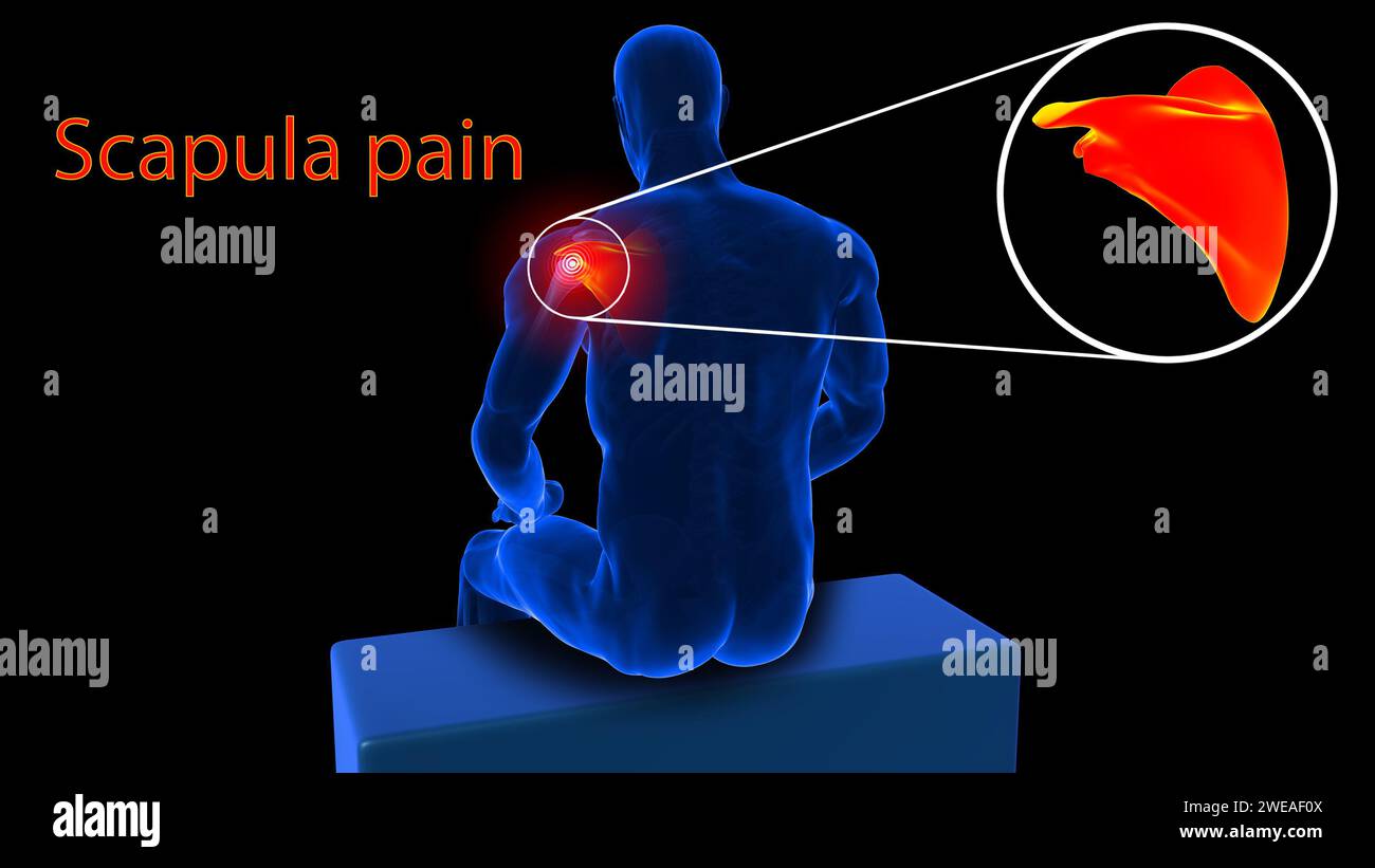 Human skeleton shoulder pain anatomy for medical concept 3D ...