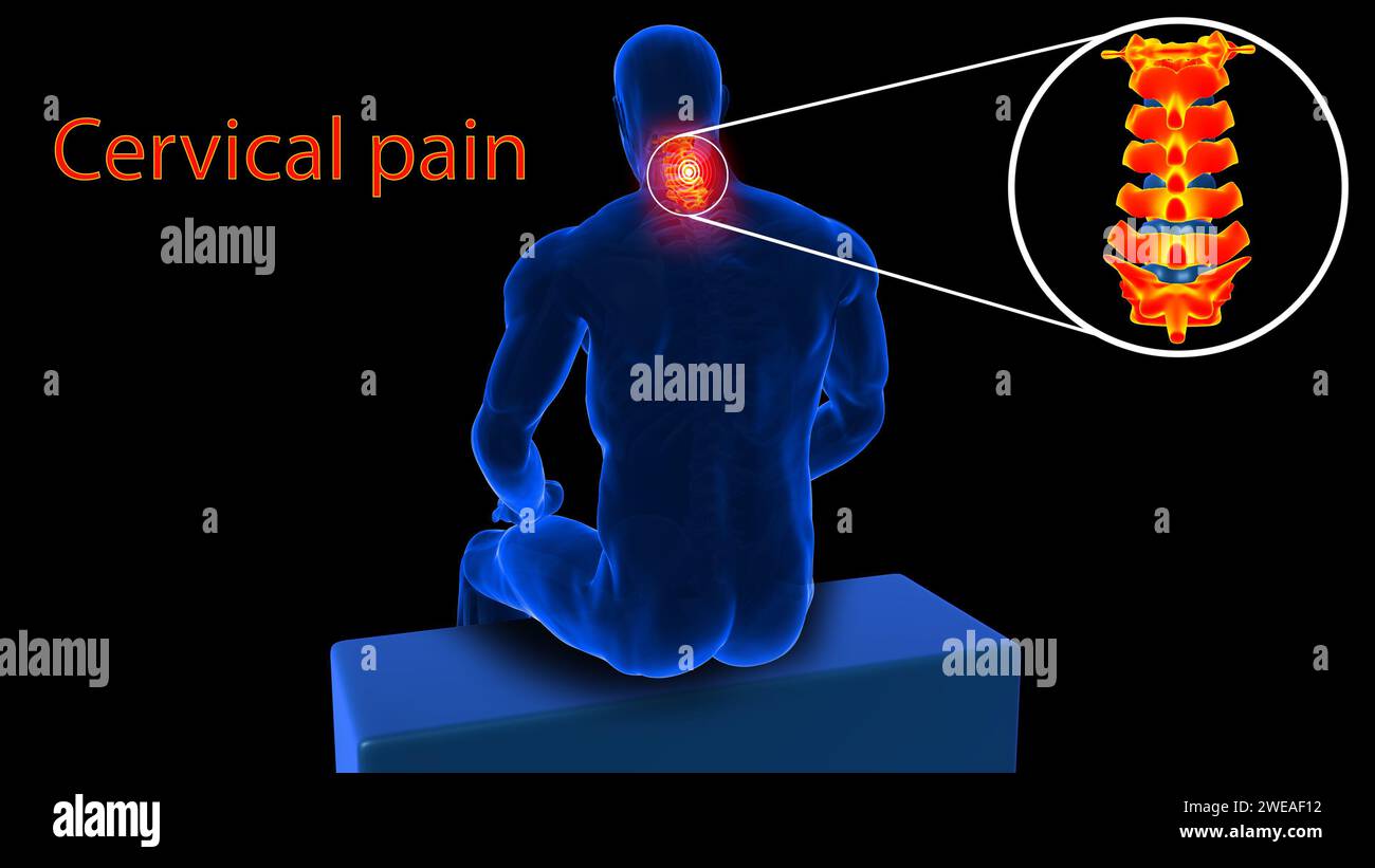 Human skeleton neck pain anatomy for medical concept 3D illustration ...