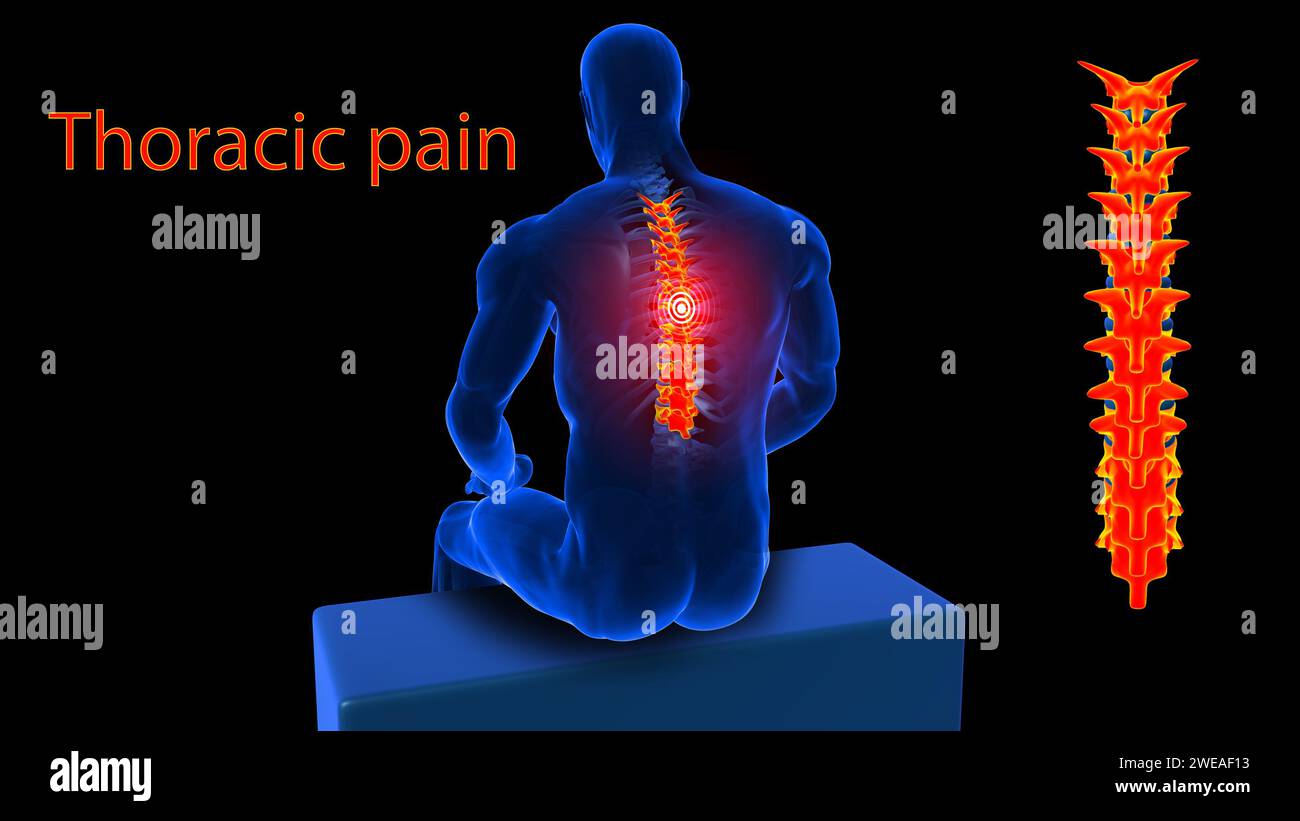 Painful upper back illustration hi-res stock photography and images - Alamy
