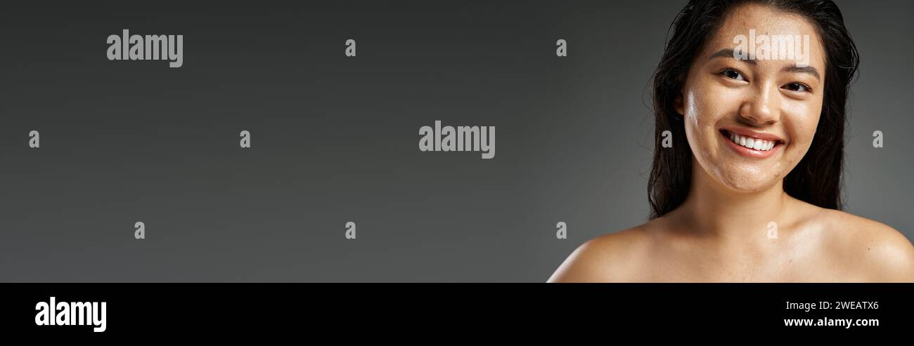 skin issues banner, happy young asian woman with pimples on wet skin ...