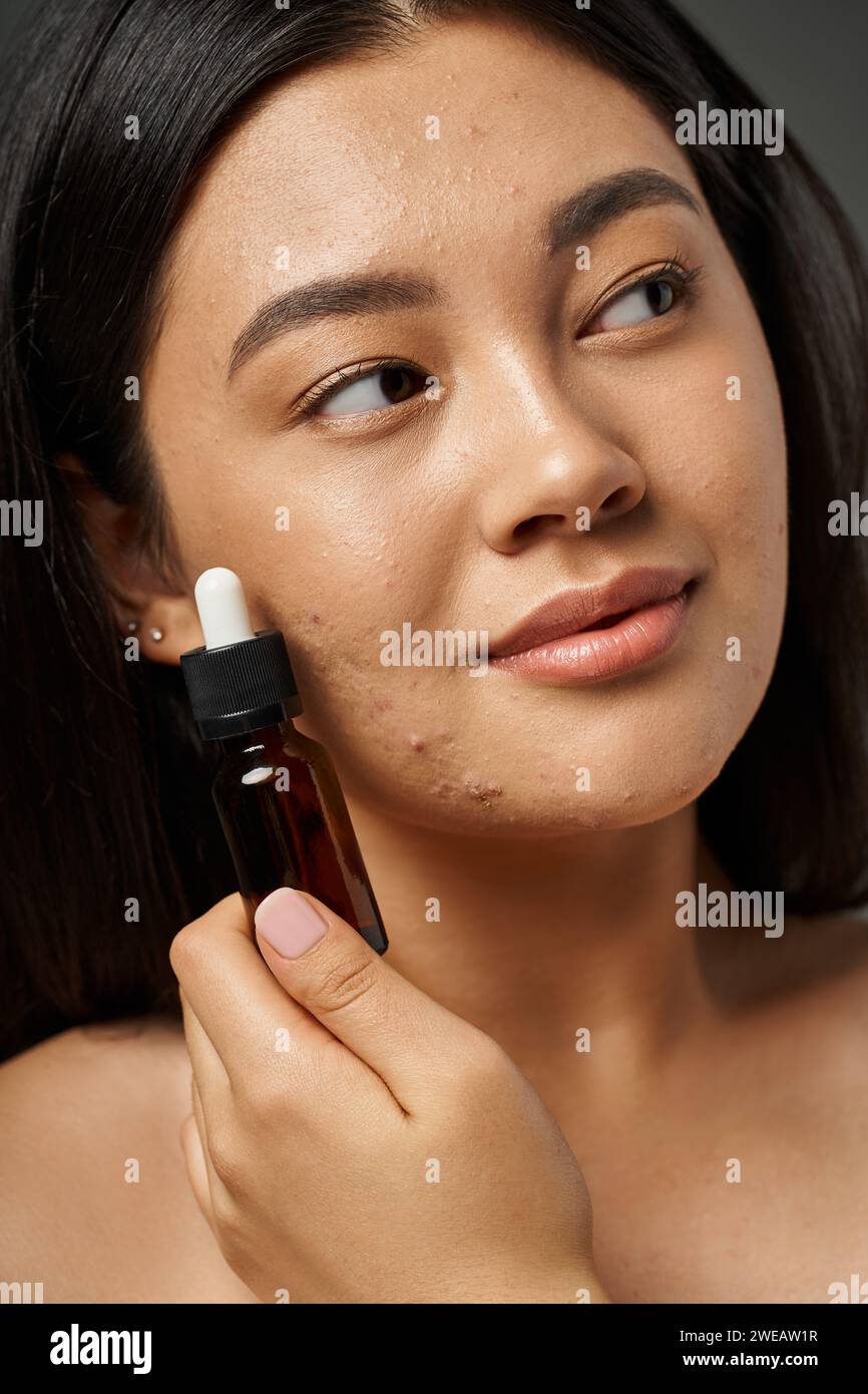 Skin blemishes hi-res stock photography and images - Alamy