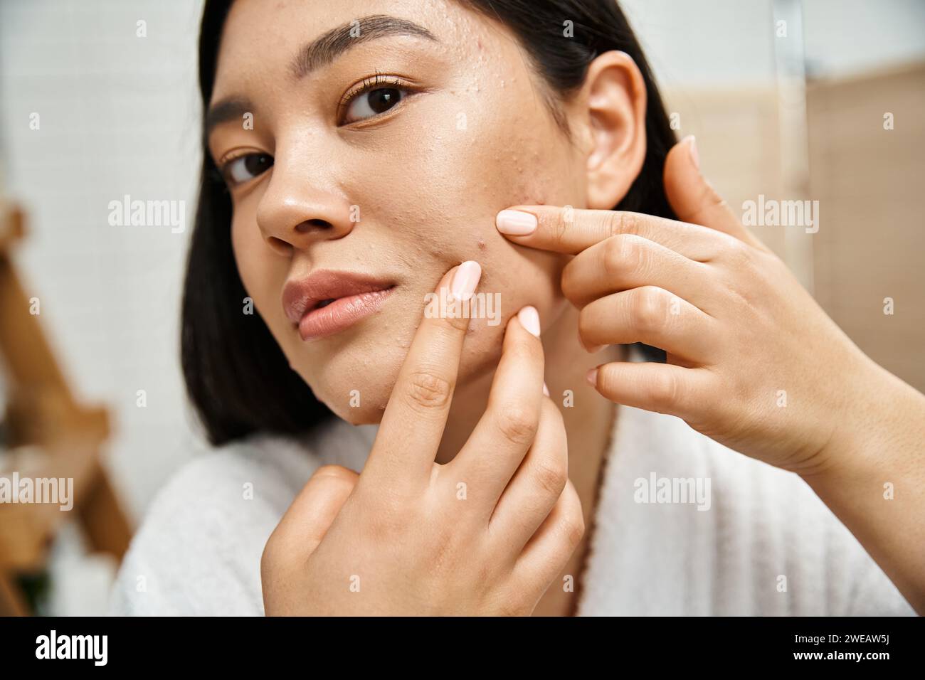 brunette and young asian woman in bath robe popping pimple on her face ...