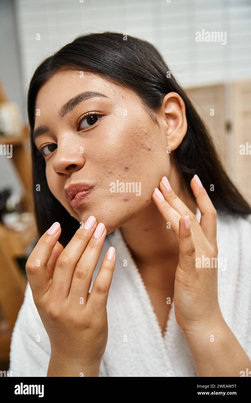 portrait of young asian woman with acne touching face and looking at ...