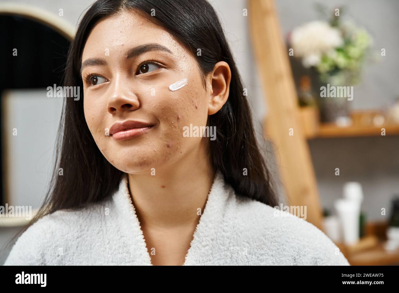 blemish treatment cream on face of young asian woman with acne looking ...