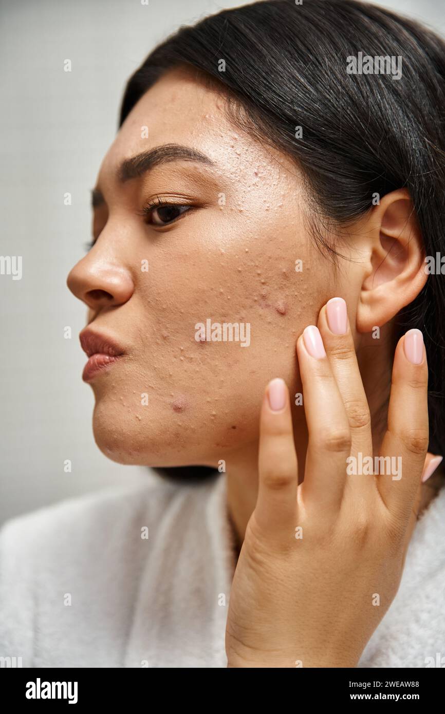 close up of young asian woman with brunette hair and pimples examining ...