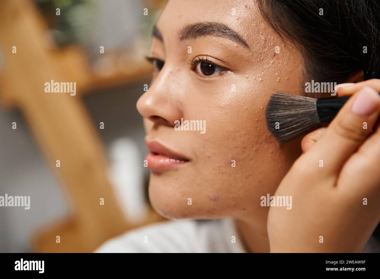 close up of young asian woman with acne prone skin applying face powder ...