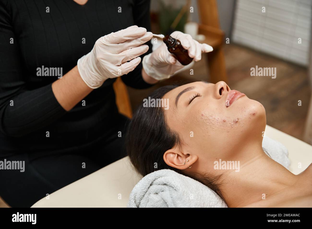 therapist applying treatment serum with cotton swab on face of asian ...