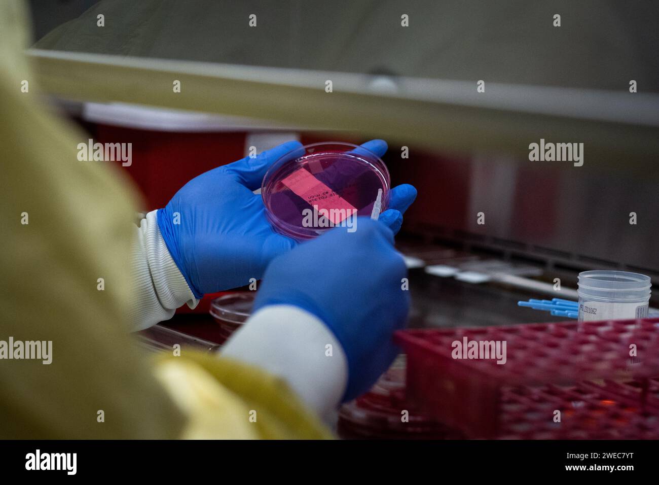 Vancouver, Canada. 23rd Jan, 2024. A microbiology lab worker prepares ...