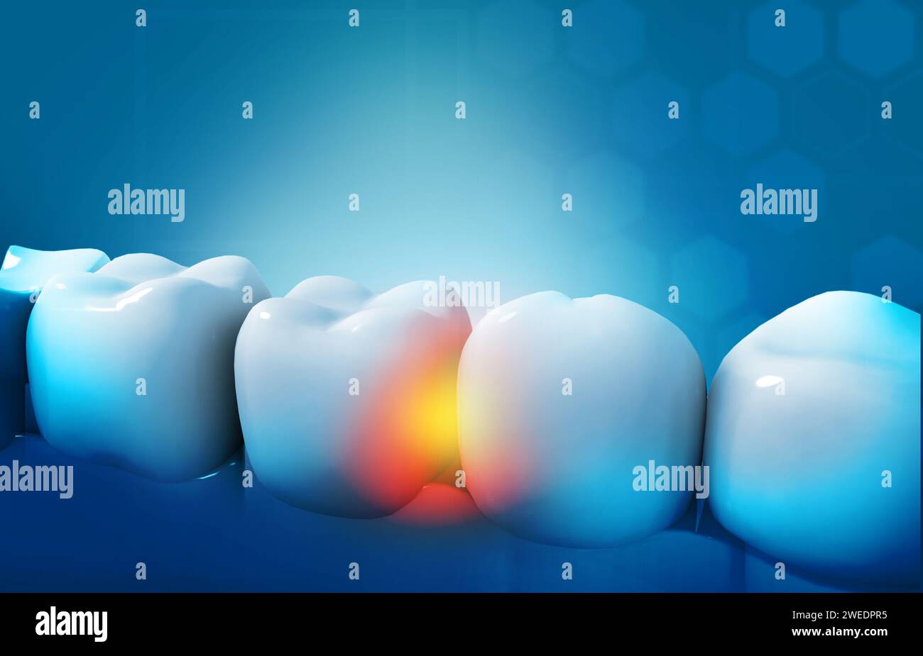Human tooth pain.3d illustration Stock Photo - Alamy
