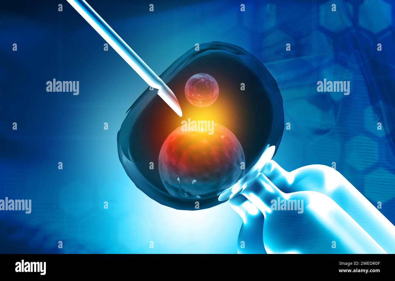 In vitro fertilization on medical background. 3d illustration Stock ...