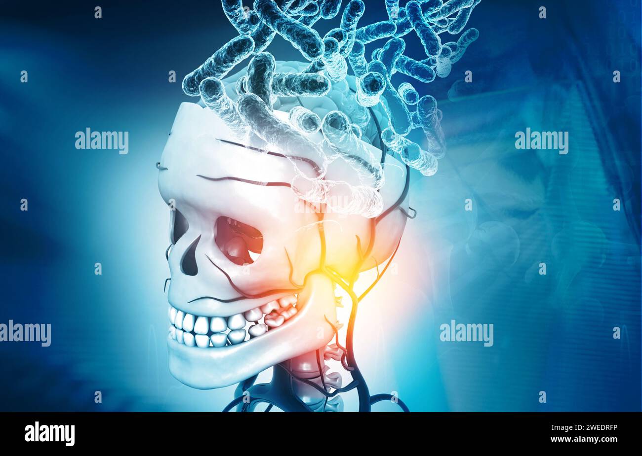 Virus attacking a human brain. 3d illustration Stock Photo - Alamy