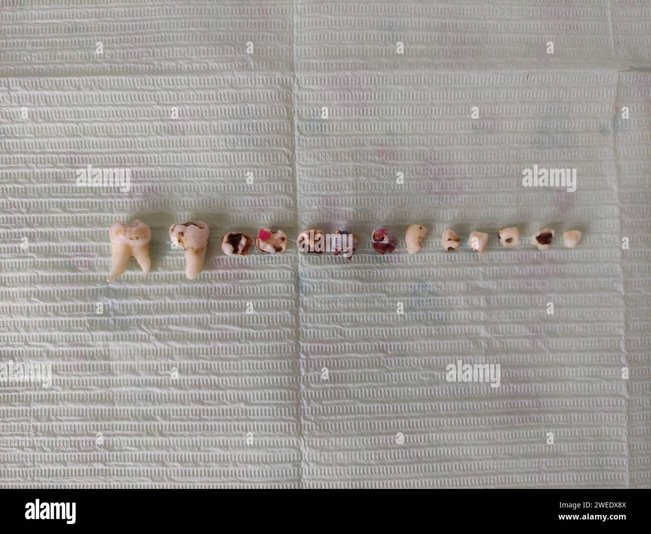 Human teeth row hi-res stock photography and images - Alamy