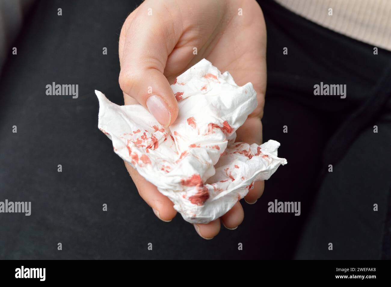 Close up hand holding bloody hi-res stock photography and images - Alamy