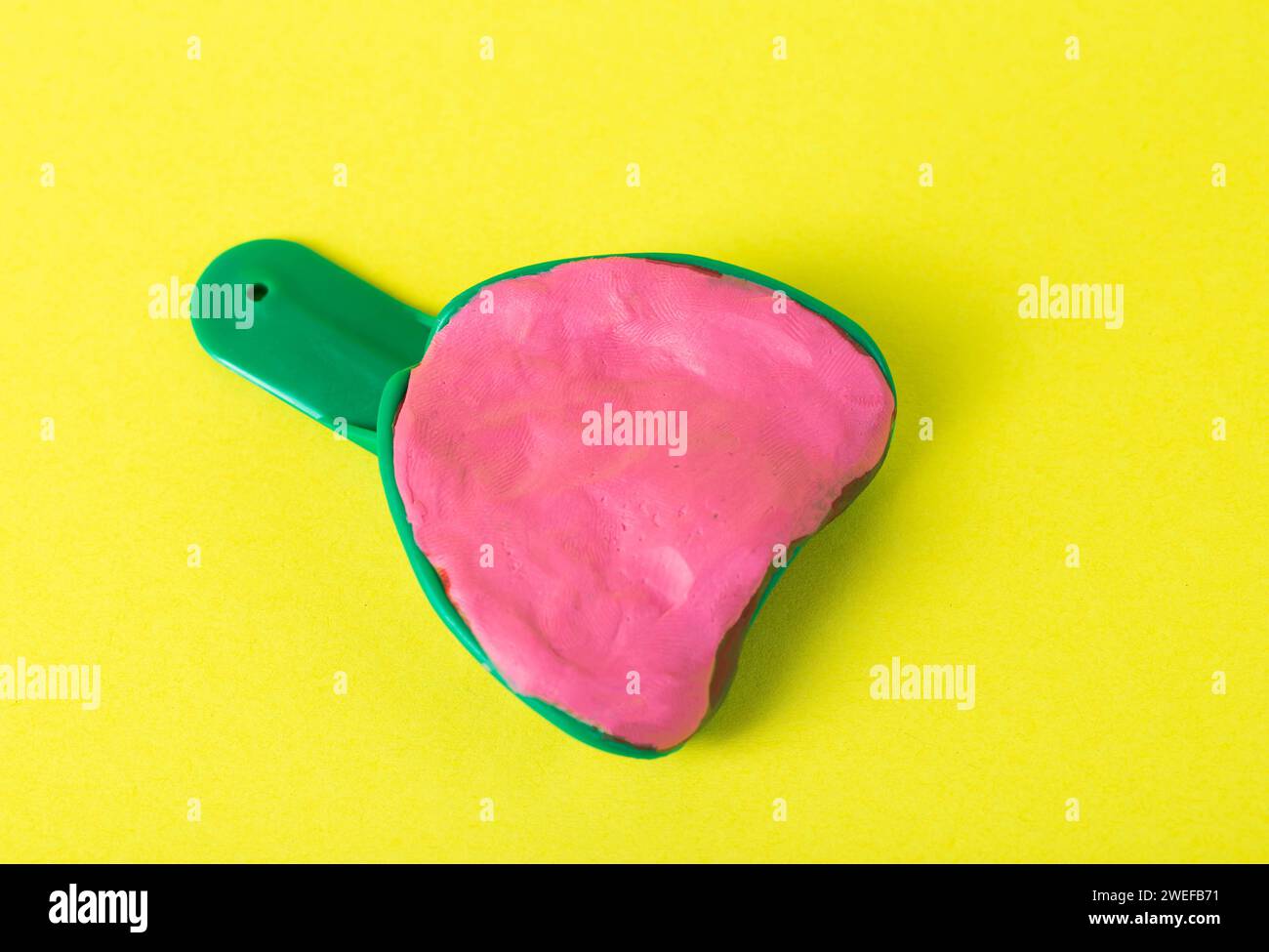 Green dental tray with alginate plastic mass for taking an impression ...