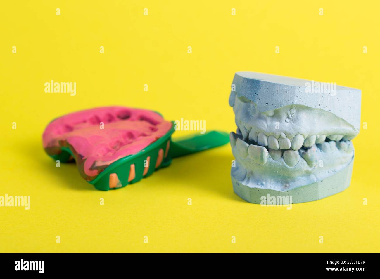 Dental spoon with alginate plastic mass for taking an impression of the ...