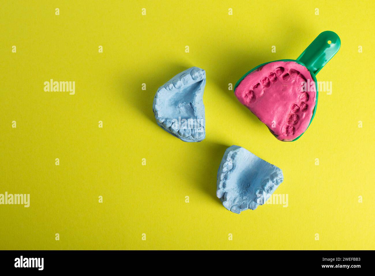 Dental spoon with alginate plastic mass for taking an impression of the ...